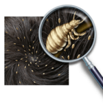 Läusebisse - Läuse bekämpfen